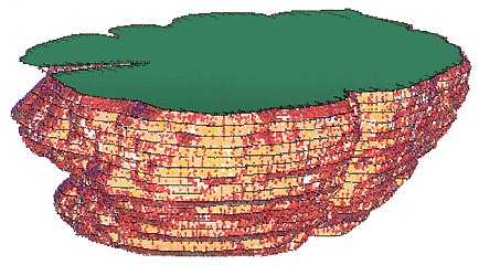 X-ray CT Human Brain reconstruction